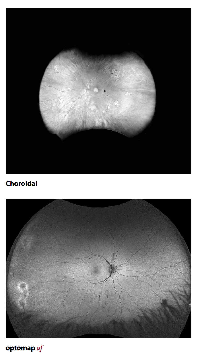 Optos Daytona Eye Retina Scanners December 13th 2020 3 – exZACKta MOUNTas